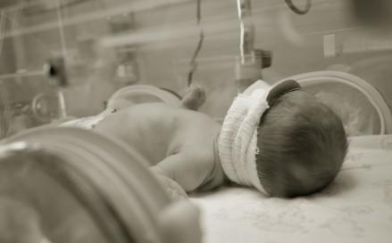Effects of Resuscitation on Preemie Babies | LoveToKnow