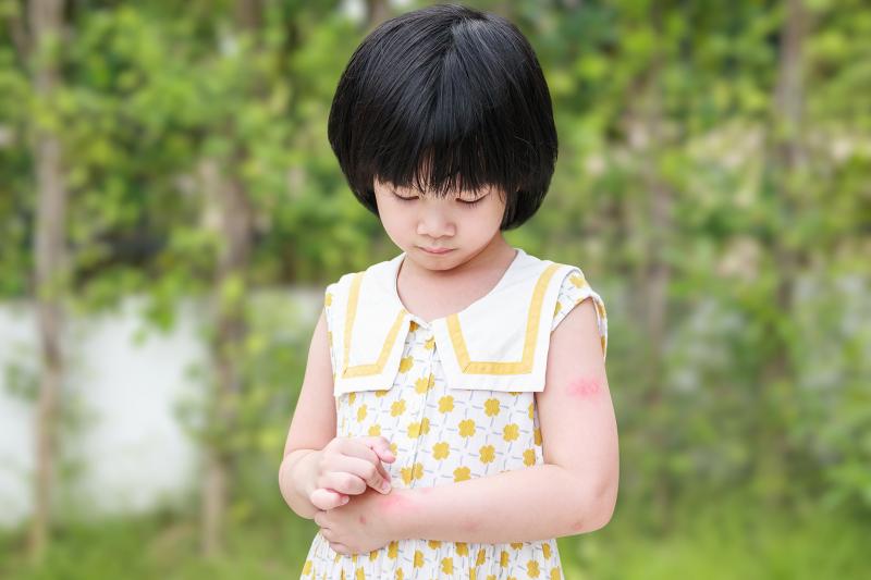 Why Your Child's a Mosquito Magnet & How to Prevent the Bites | LoveToKnow