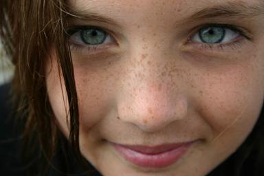 Why Do People Have Freckles | LoveToKnow Health & Wellness