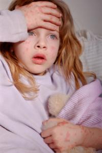 Heat Rash Pictures | LoveToKnow